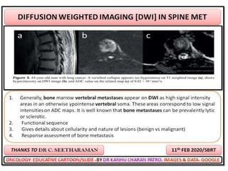 ANATOMY OF MRI SPINE | PPTX