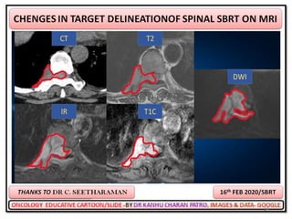 ANATOMY OF MRI SPINE | PPTX