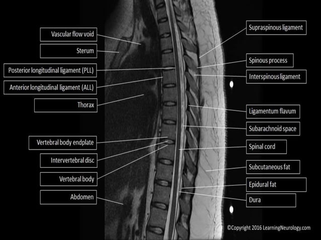 ANATOMY OF MRI SPINE