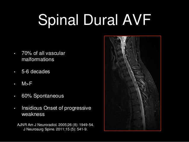 Spine mri bir 2 copy