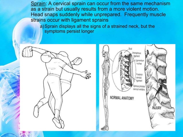 Spine Powerpoint.ppt