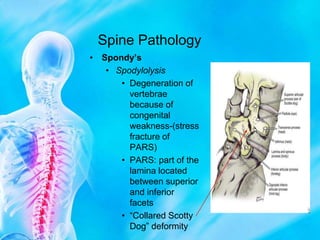 Spine Powerpoint.ppt