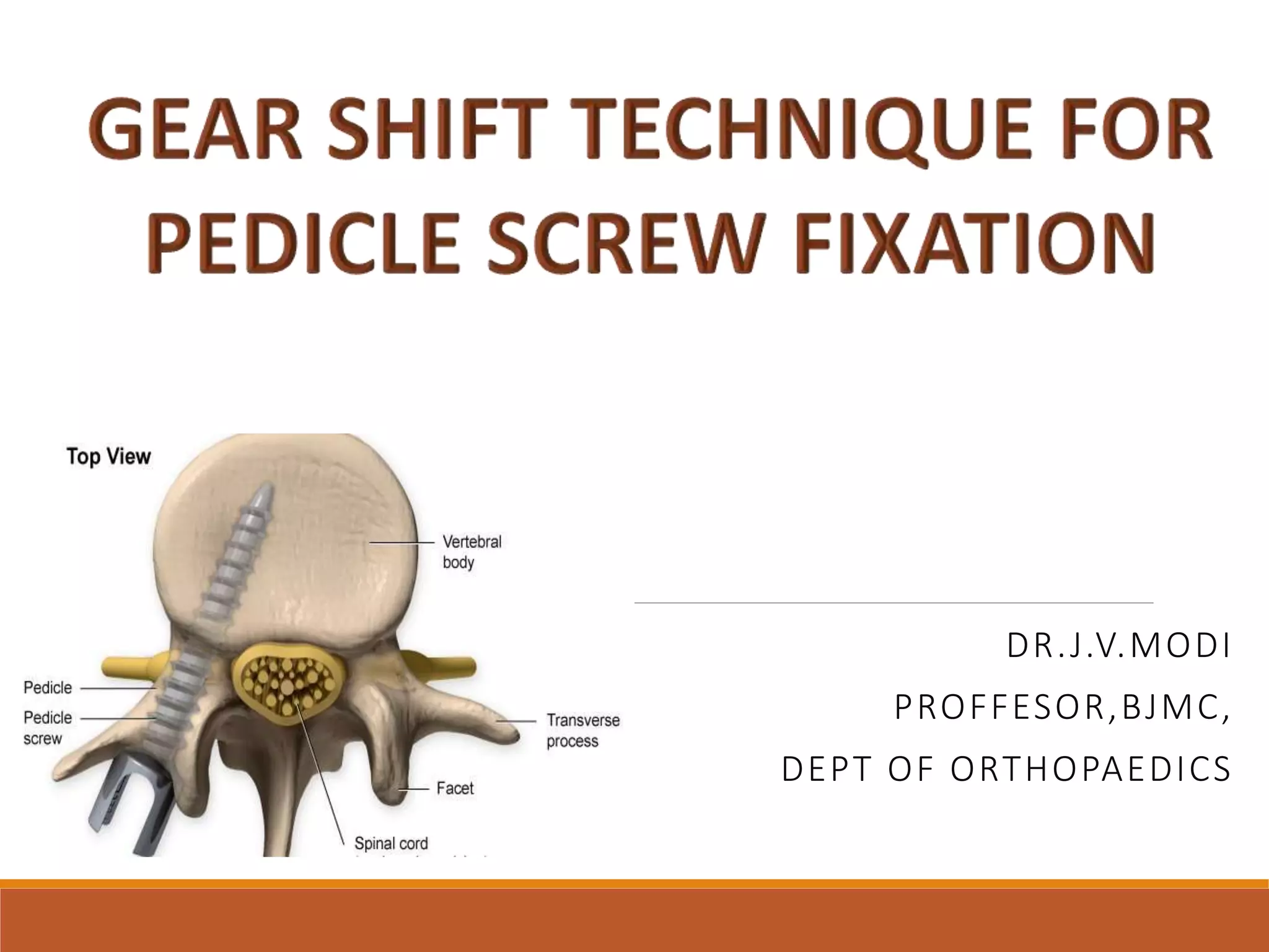 pedicle screw insertion | PPTX