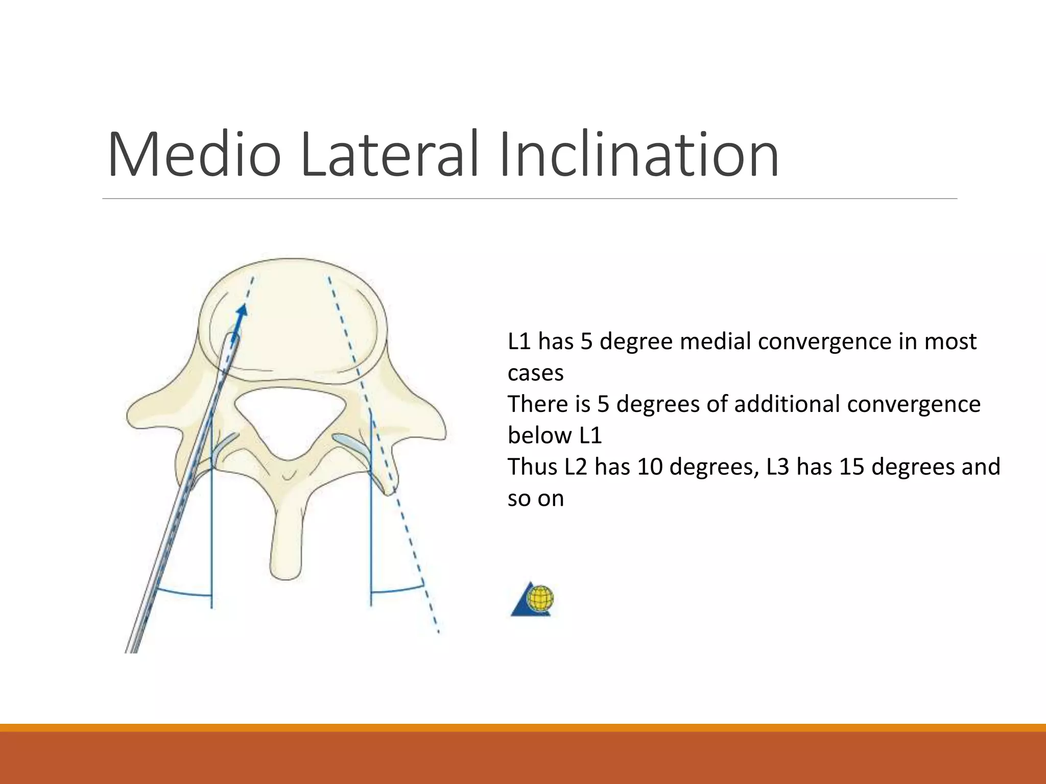pedicle screw insertion | PPTX