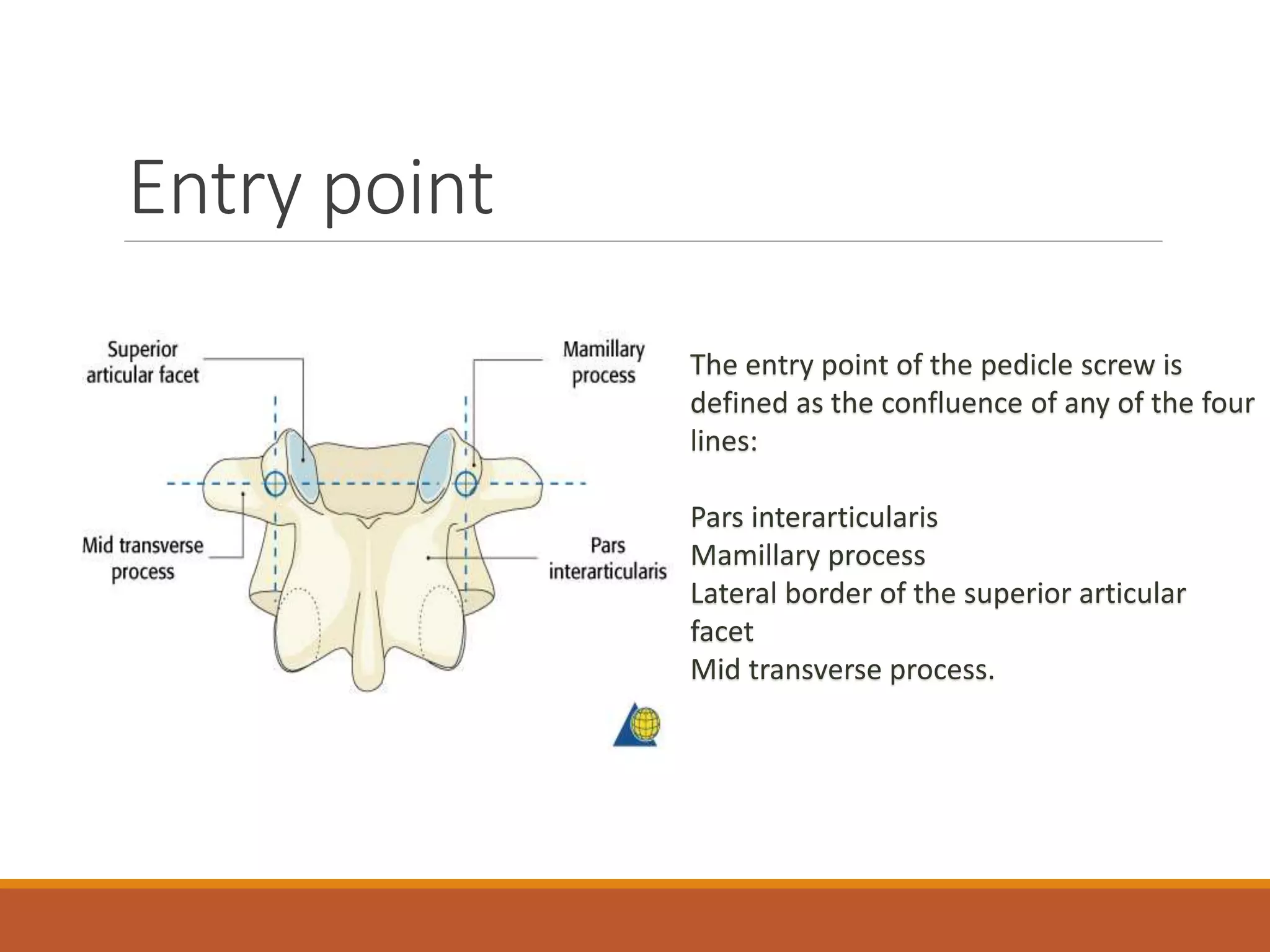 pedicle screw insertion | PPTX