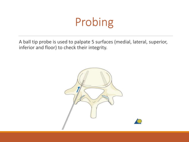 pedicle screw insertion | PPTX