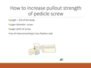 pedicle screw insertion | PPTX