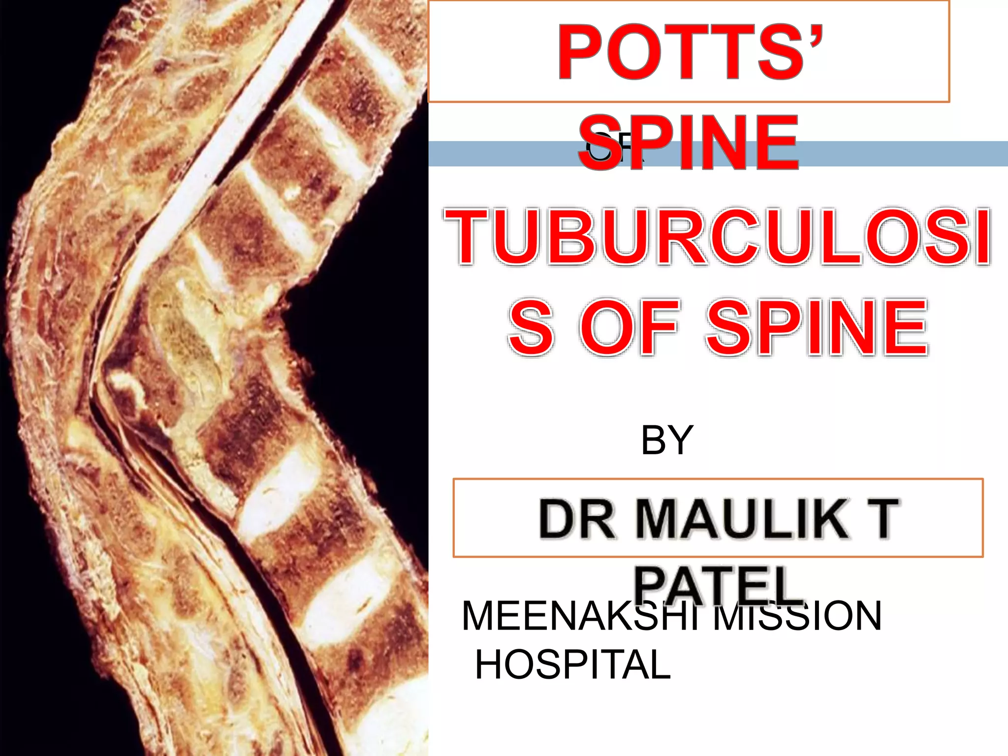 Spine presentation | PPTX