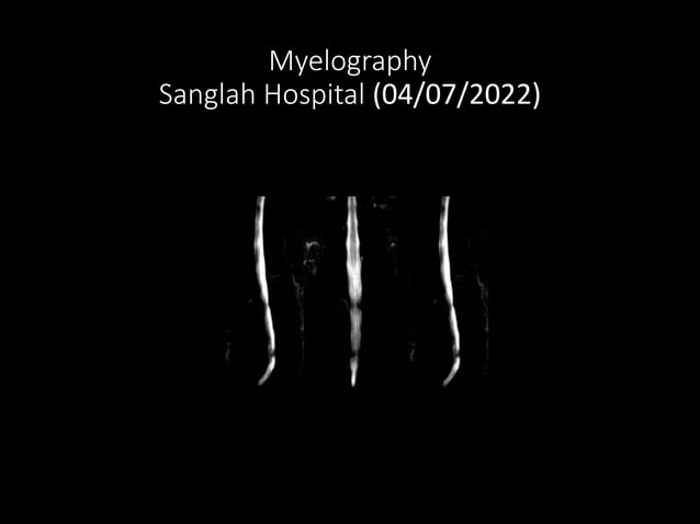 Spine print ini.pptx