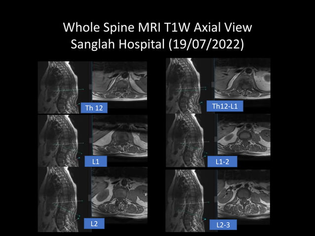 Spine print ini.pptx