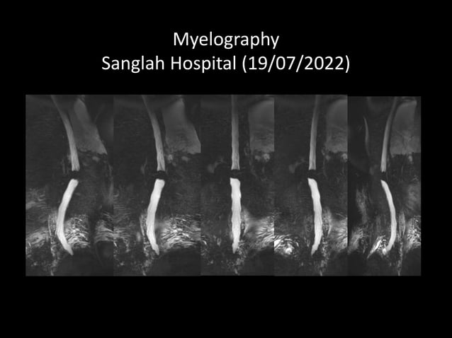 Spine print ini.pptx