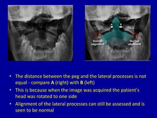 Spine radiography | PPTX