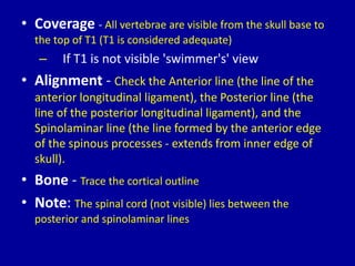 Spine radiography | PPTX