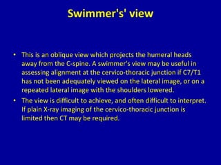 Swimmers View X Ray