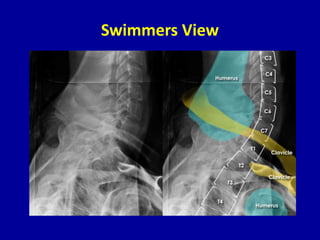 Swimmers View X Ray