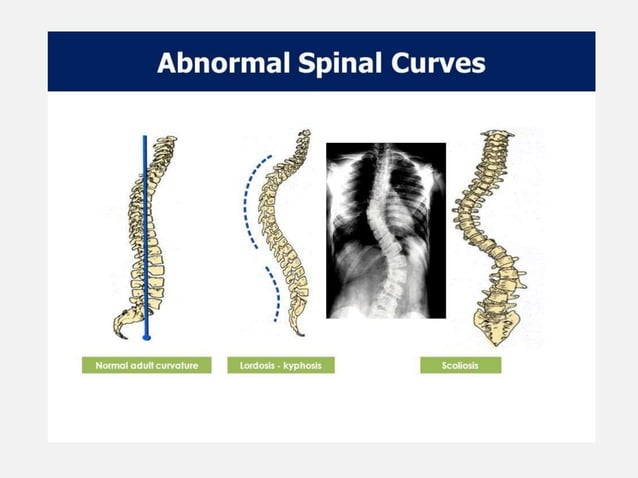 cervical thoracic lumbar sacral Spine Radiography | PPT