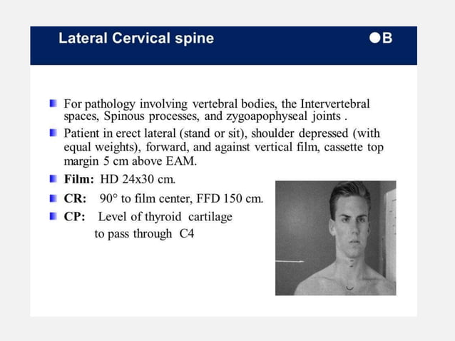 cervical thoracic lumbar sacral Spine Radiography | PPT