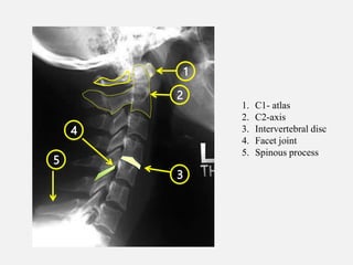 cervical thoracic lumbar sacral Spine Radiography | PPTX