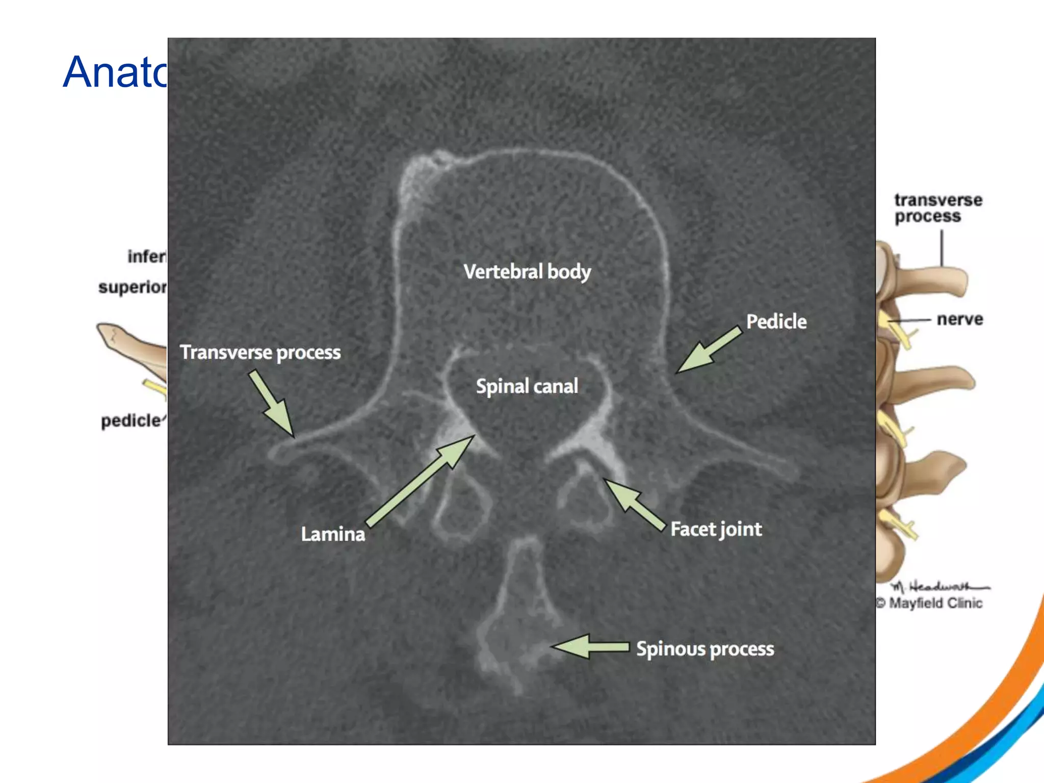 SPINE SBRT for beginners | PPTX
