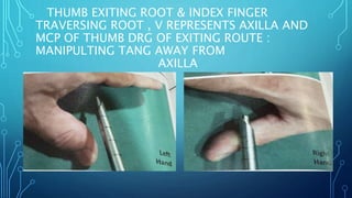 journey from skin to disc in a transforaminal surgery .pptx