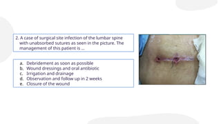 Spine Surgical Site Infection-1.pptx scrubbing | PPTX