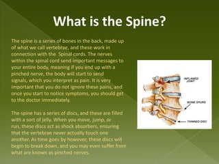 Spine tech neurosurgery in beaumont tx | PPTX