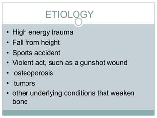 Spine trauma basics | PPTX
