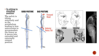 Spino-pelvic relation to total hip replacment.pptx