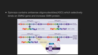 spinomuscular atrophy in children 7) (1).pptx