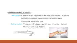SPINTS AND TRACTIONS BY DR. SHIVANI GOYAL | PPTX