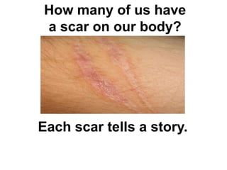 Spiritual scars | PPTX | Christianity | Religion & Spirituality