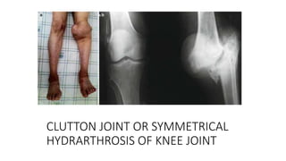 SPIROCHAETAL INFECTION in orthopaedics.pptx