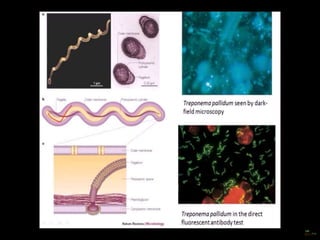 Spirochaeta pallidum | PPTX | Infectious Diseases | Diseases and Conditions
