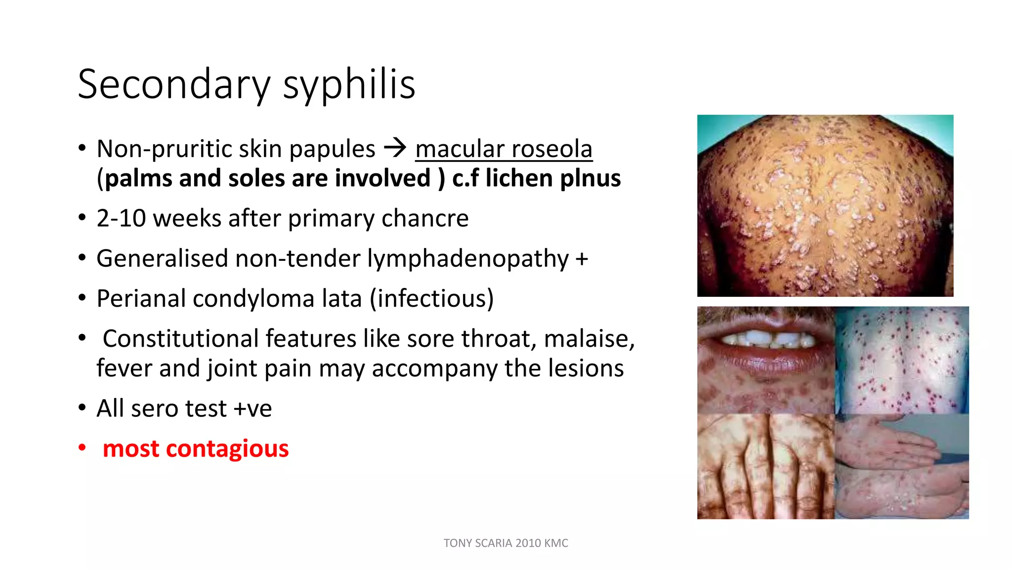 SPIROCHAETE REVISION NOTES MICROBIOLOGY | PDF