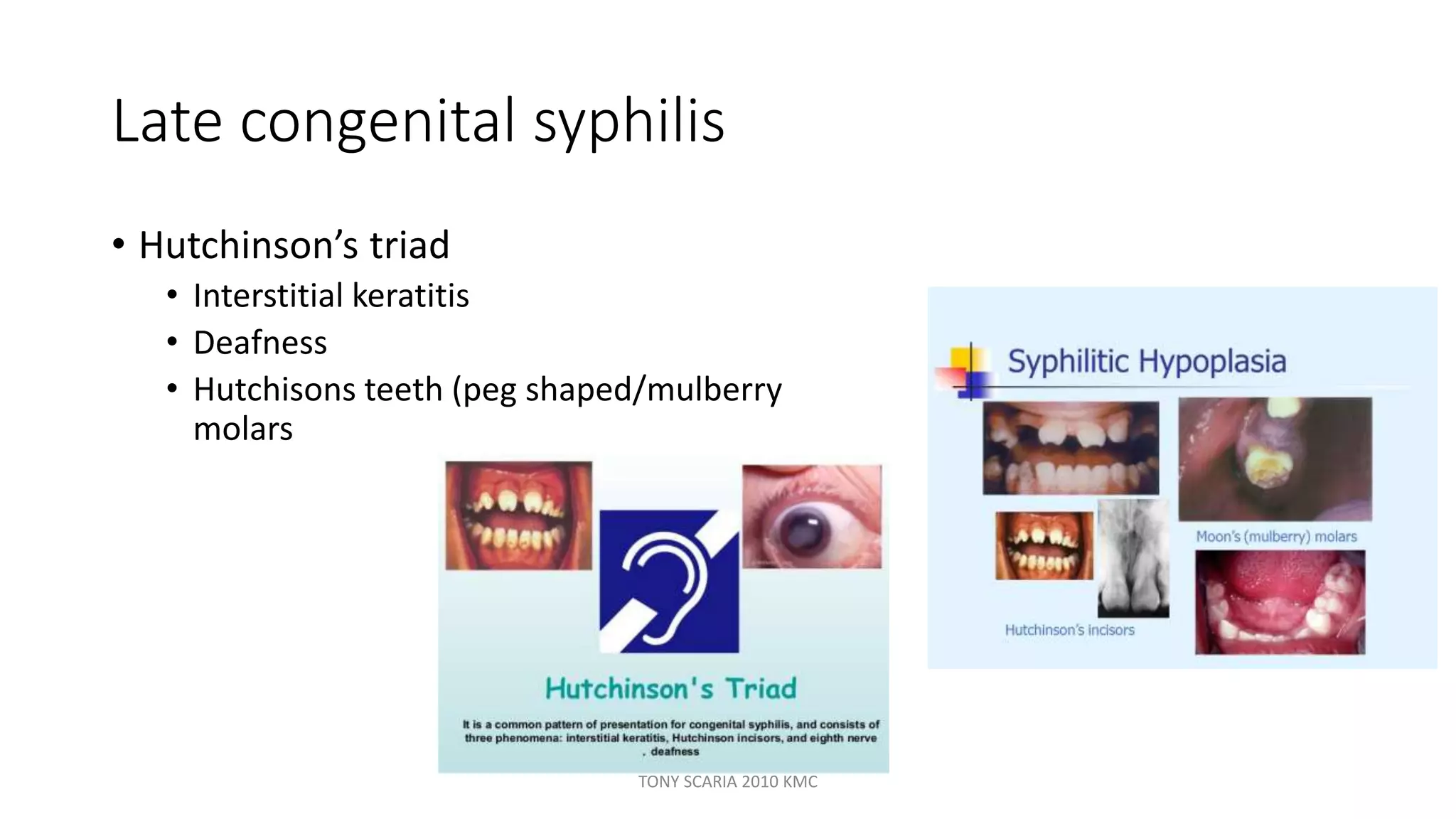 SPIROCHAETE REVISION NOTES MICROBIOLOGY | PDF