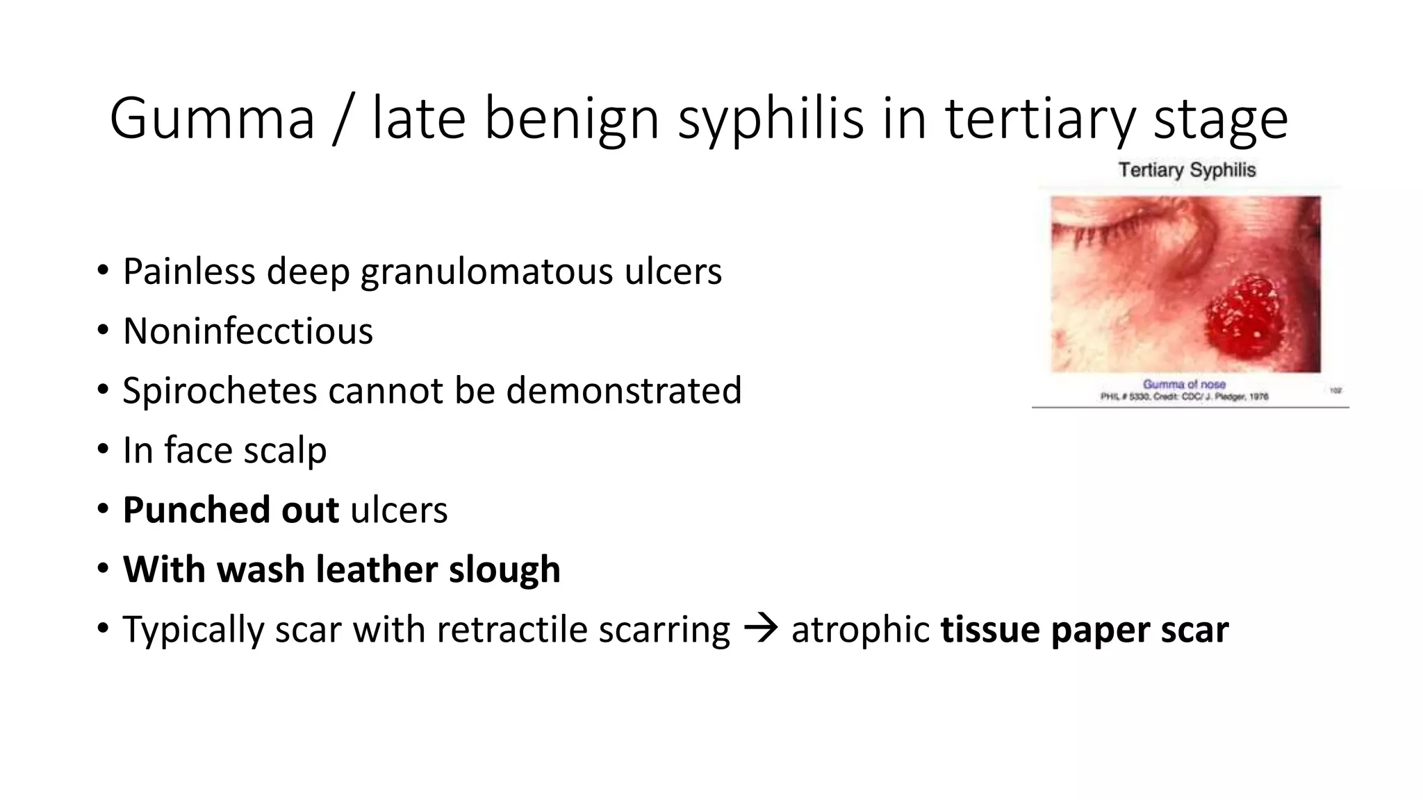 Spirochaete microbiology revision notes | PPT
