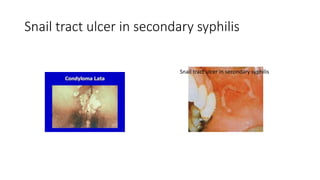 Spirochaete microbiology revision notes | PPTX