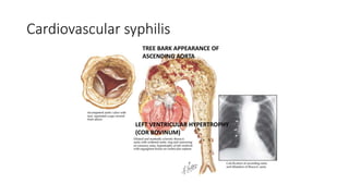 Spirochaete microbiology revision notes | PPTX