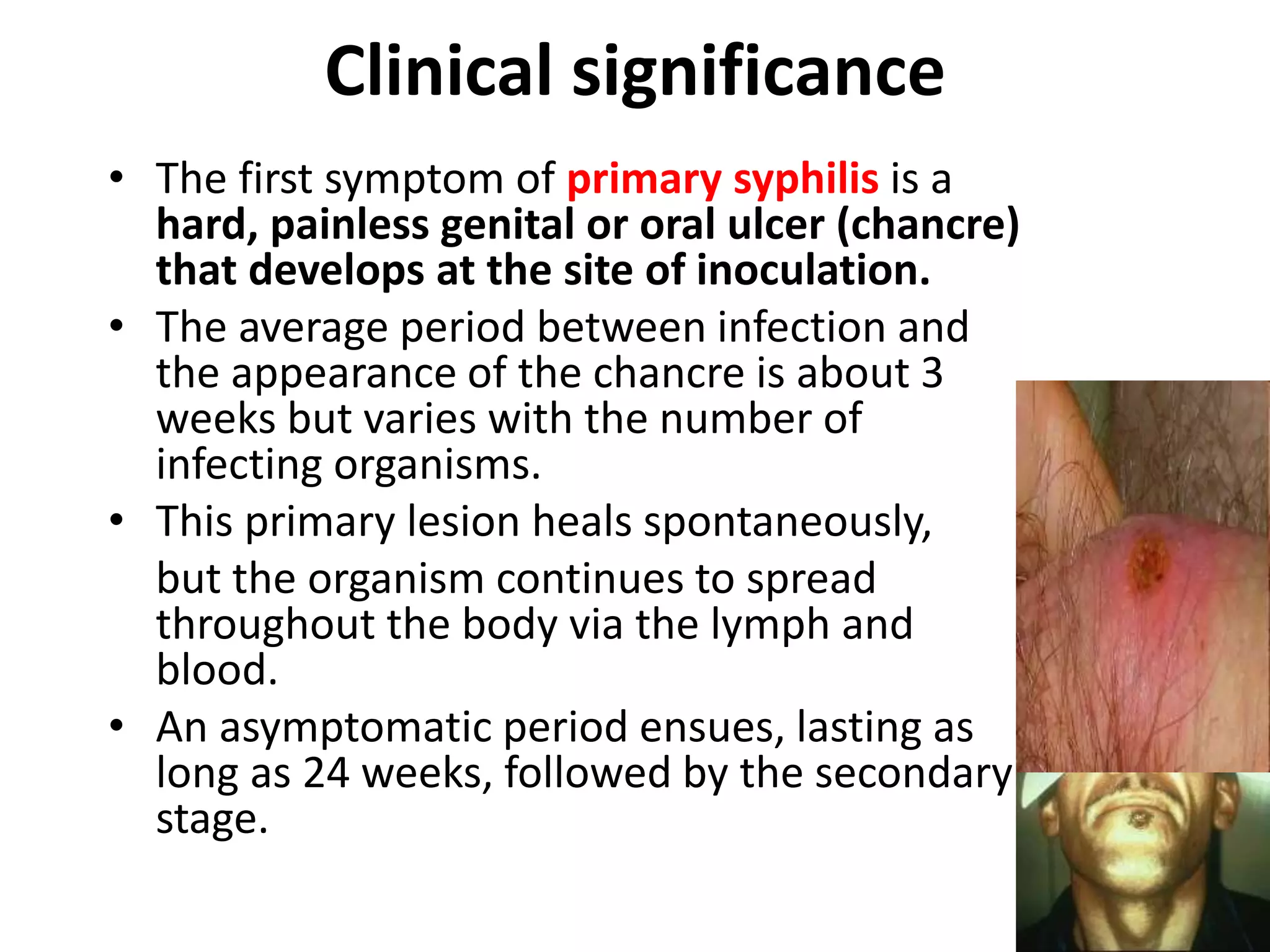 Treponema pallidum | PPTX