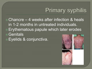 Spirochetal disease syphilis | PPT