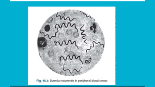 Spirochete.pptx