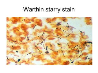 Spirochetes | PPT | Infectious Diseases | Diseases and Conditions