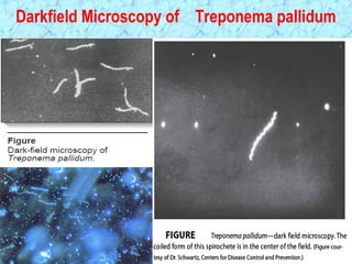 Spirochetes | PPT