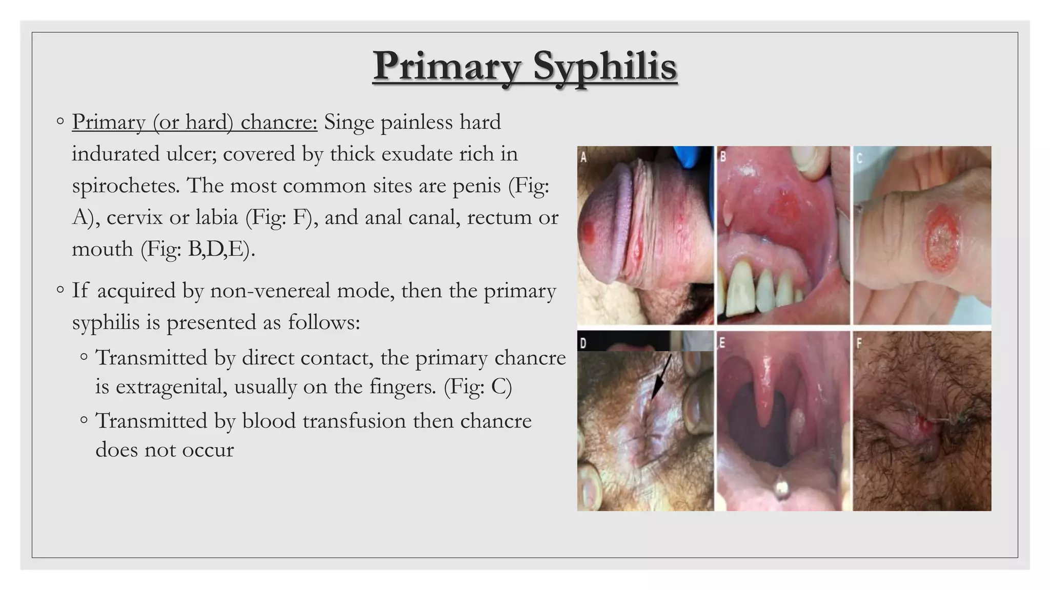 Spirochetes | PPTX