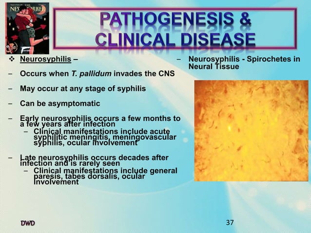 Spirochetes (treponema pallidum 1) | PPTX