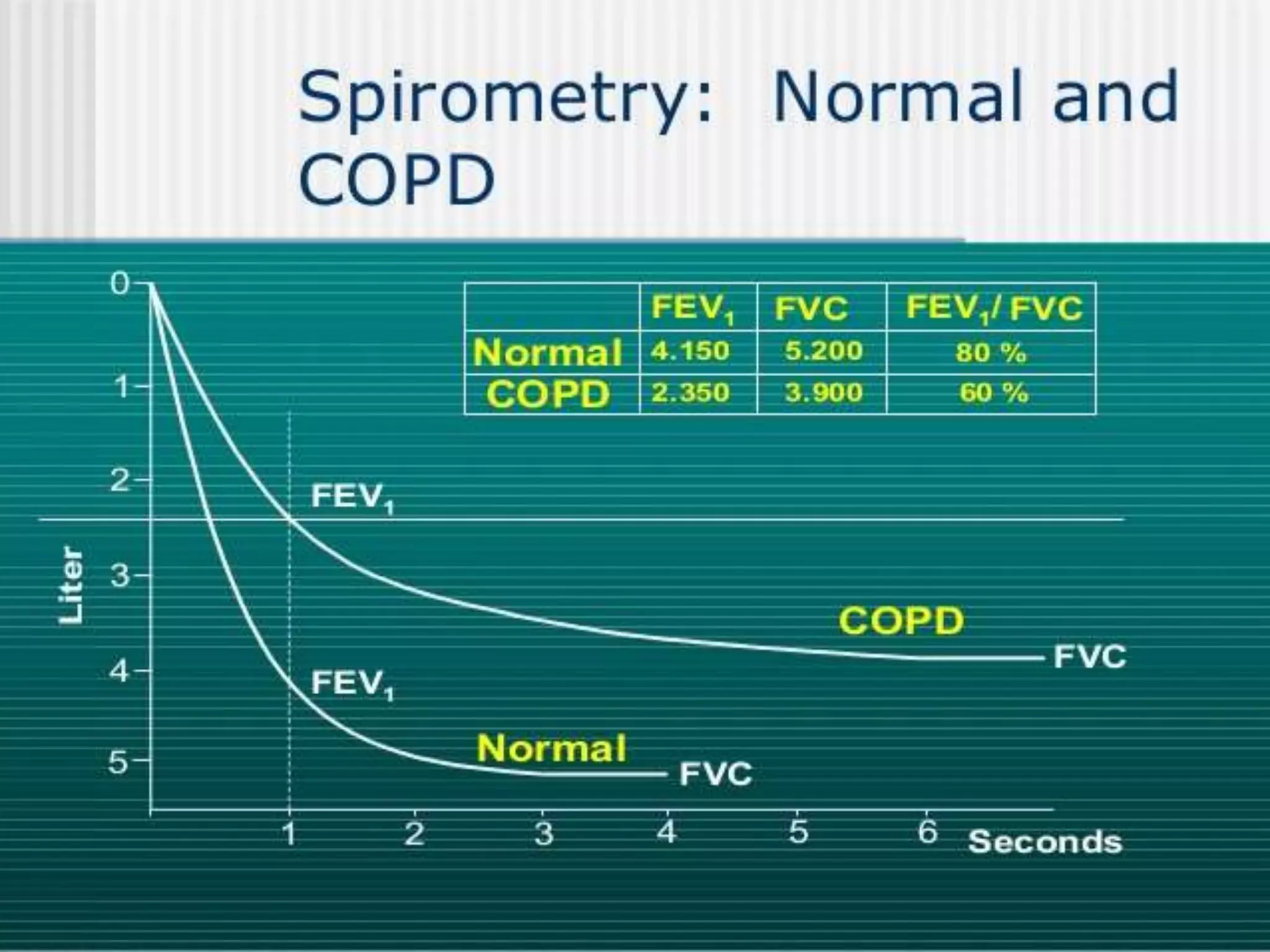 Spirometer- Usage and Maintenance | PPTX