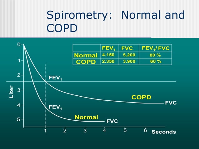 Spirometry | PPT