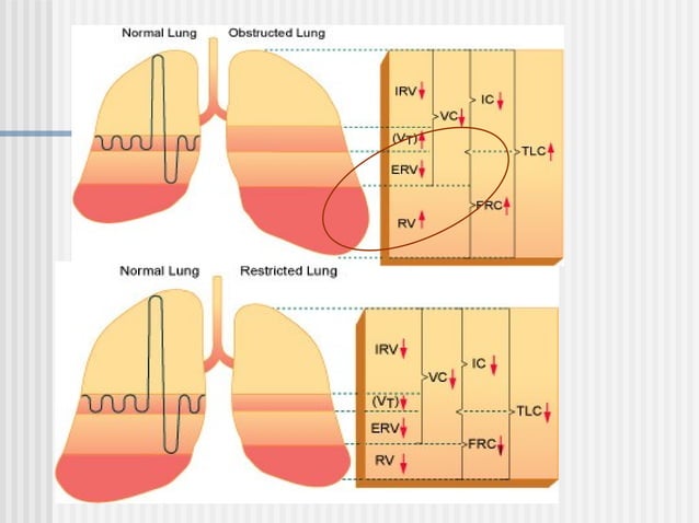Spirometry | PPT