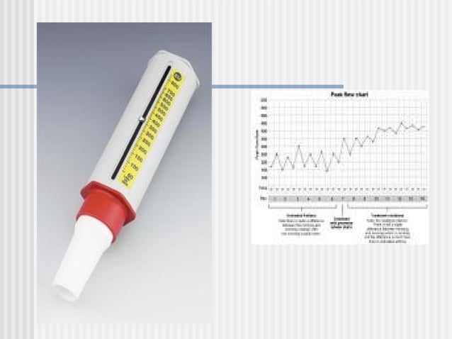 Spirometry | PPT