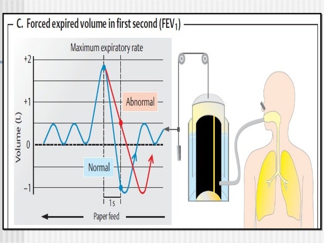 Spirometry